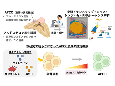 原発性アルドステロン症、ストレス応答がAPCC形成の引き金と判明－九大 - QLifePro 医療ニュース